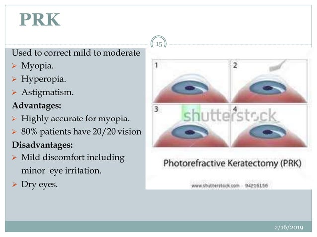 cornealrefractivesurgery-190216085714.pdf