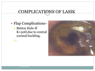 cornealrefractivesurgery-190216085714.pdf