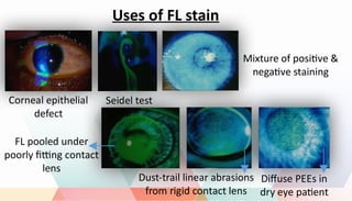 Different types of Corneal Staining.pptx