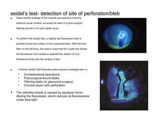 corneal staining including fluorescien, lissamine green and rose bengal ...