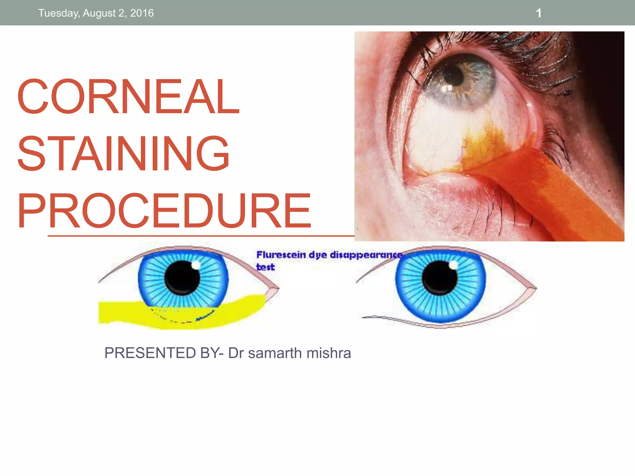 Corneal staining procedure | PPTX