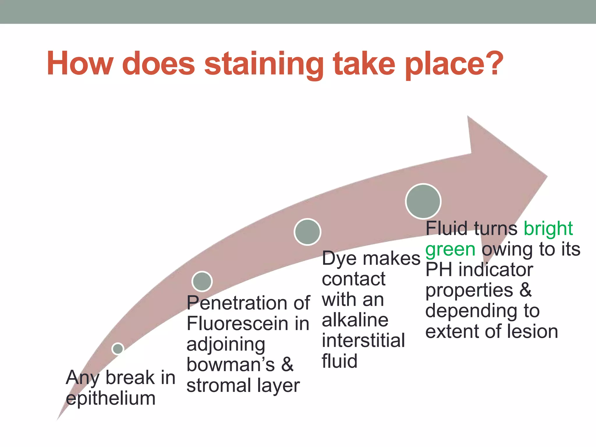 Corneal staining procedure | PPTX