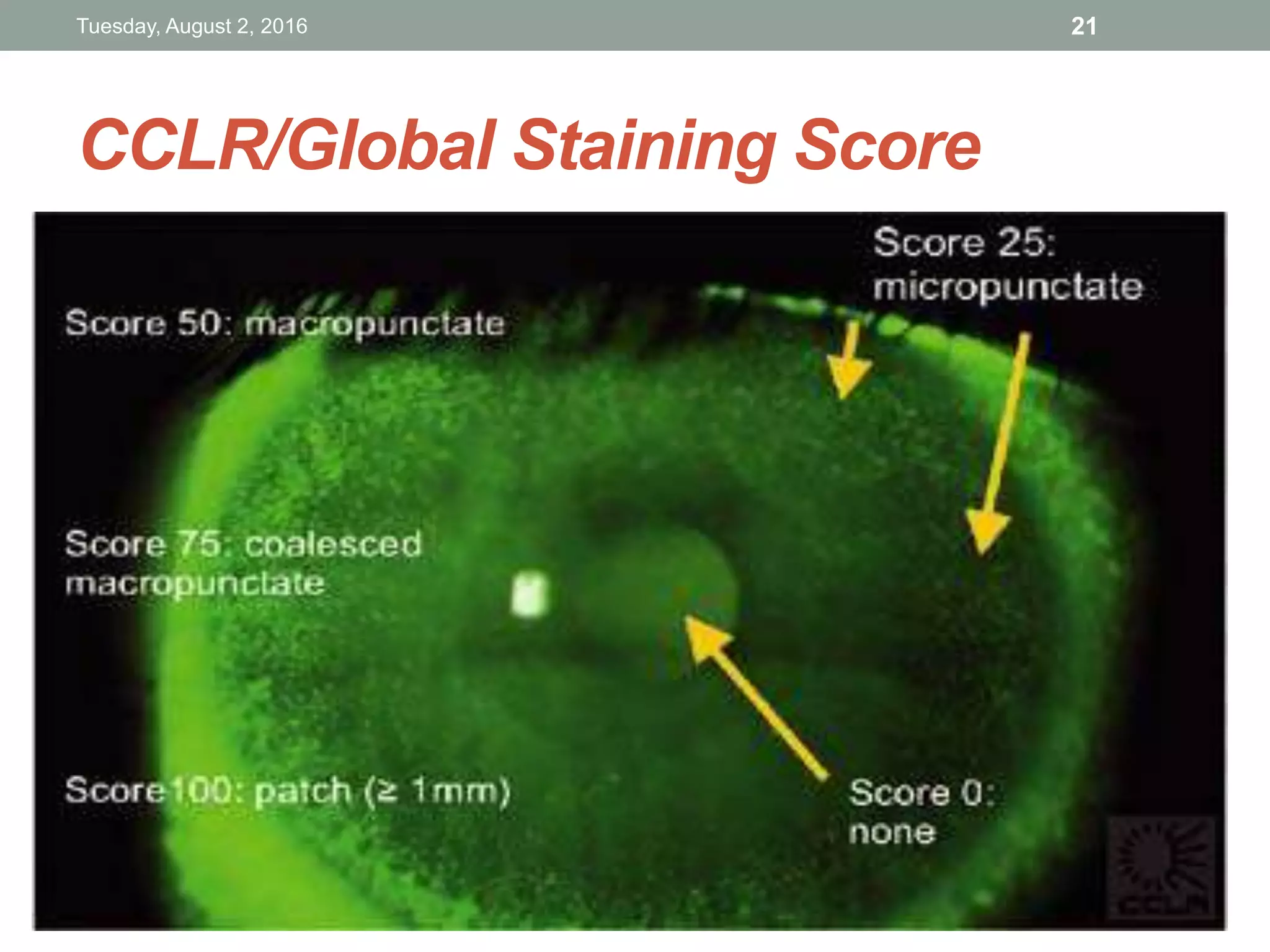 Corneal staining procedure | PPTX