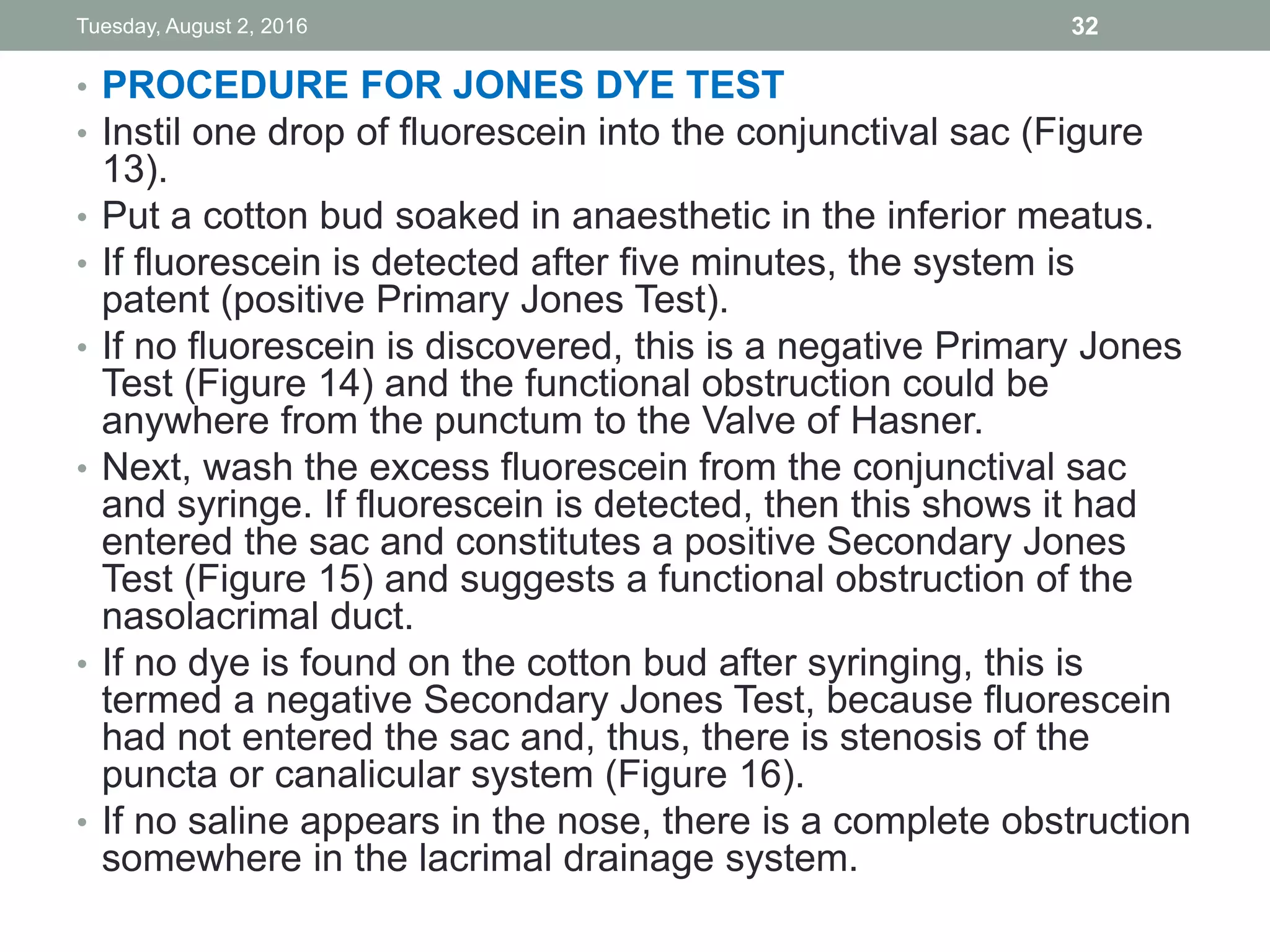 Corneal staining procedure | PPTX
