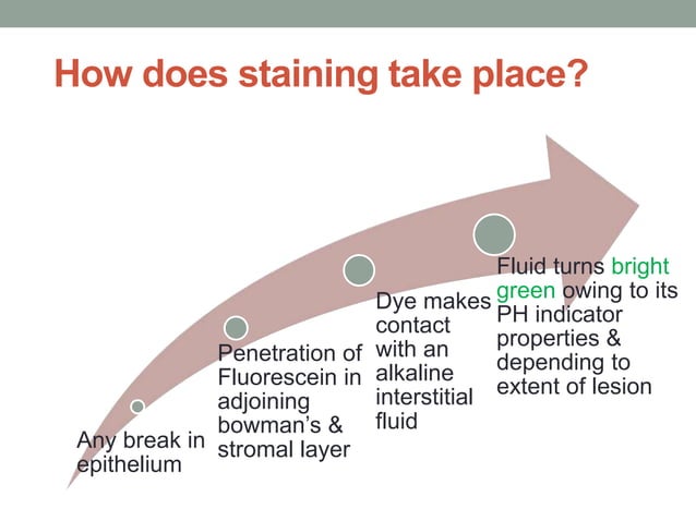 Corneal staining procedure | PPTX
