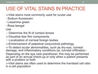 Corneal staining procedure | PPTX