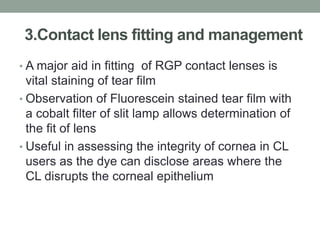 Corneal staining procedure | PPTX