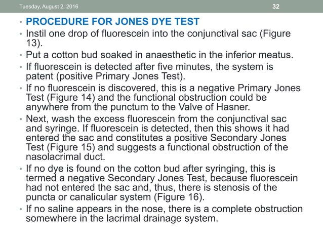 Corneal staining procedure | PPTX