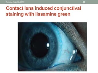 Corneal staining procedure | PPTX