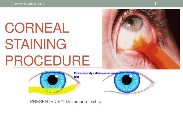 Corneal staining procedure