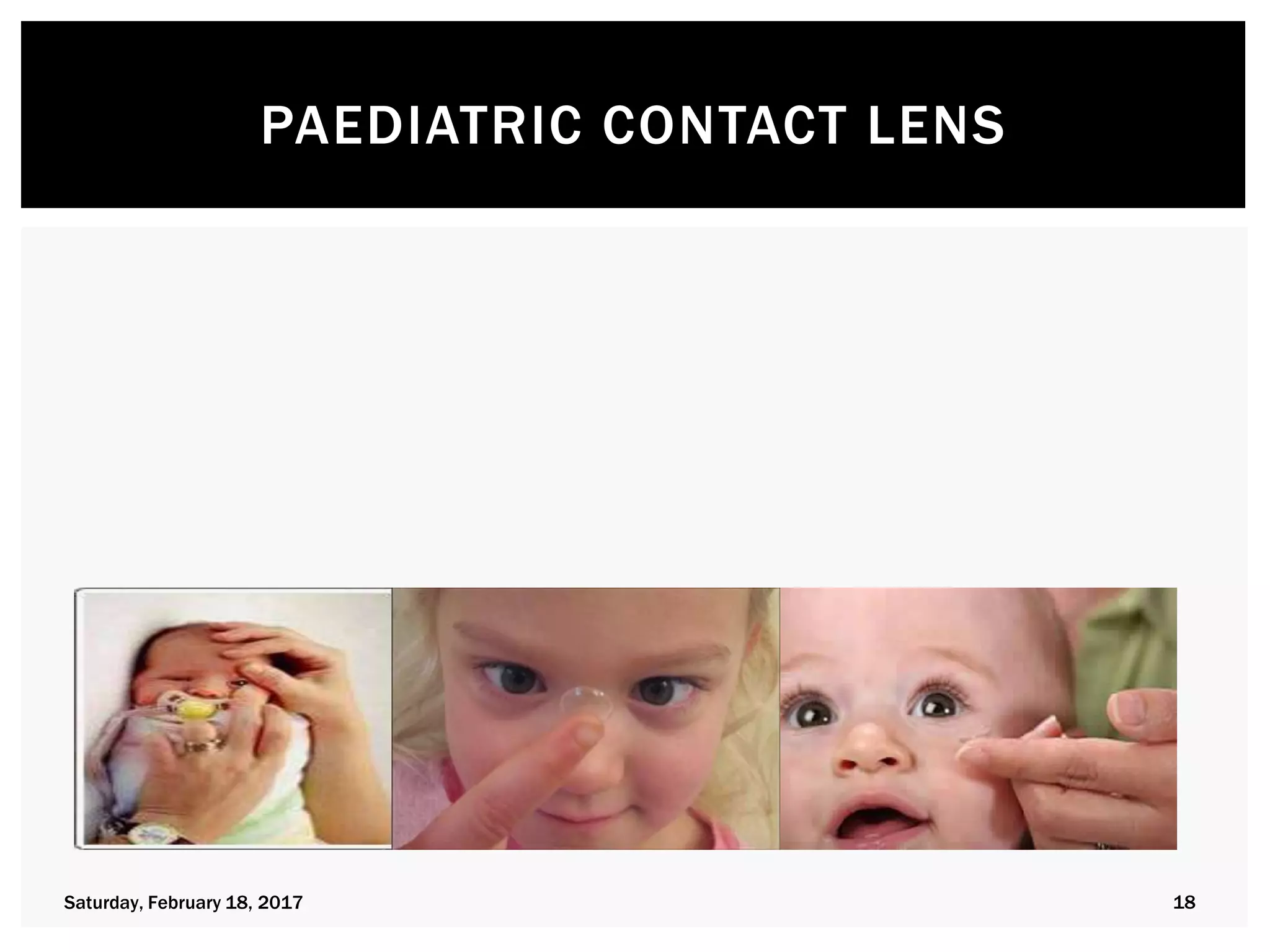 Corneal Topography Corneal Cross Linking Pediatric and Presbyopic ...