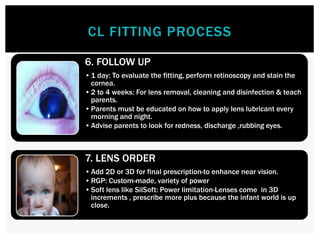 Corneal Topography Corneal Cross Linking Pediatric and Presbyopic ...