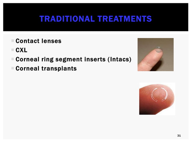 Corneal Topography Corneal Cross Linking Pediatric and Presbyopic ...