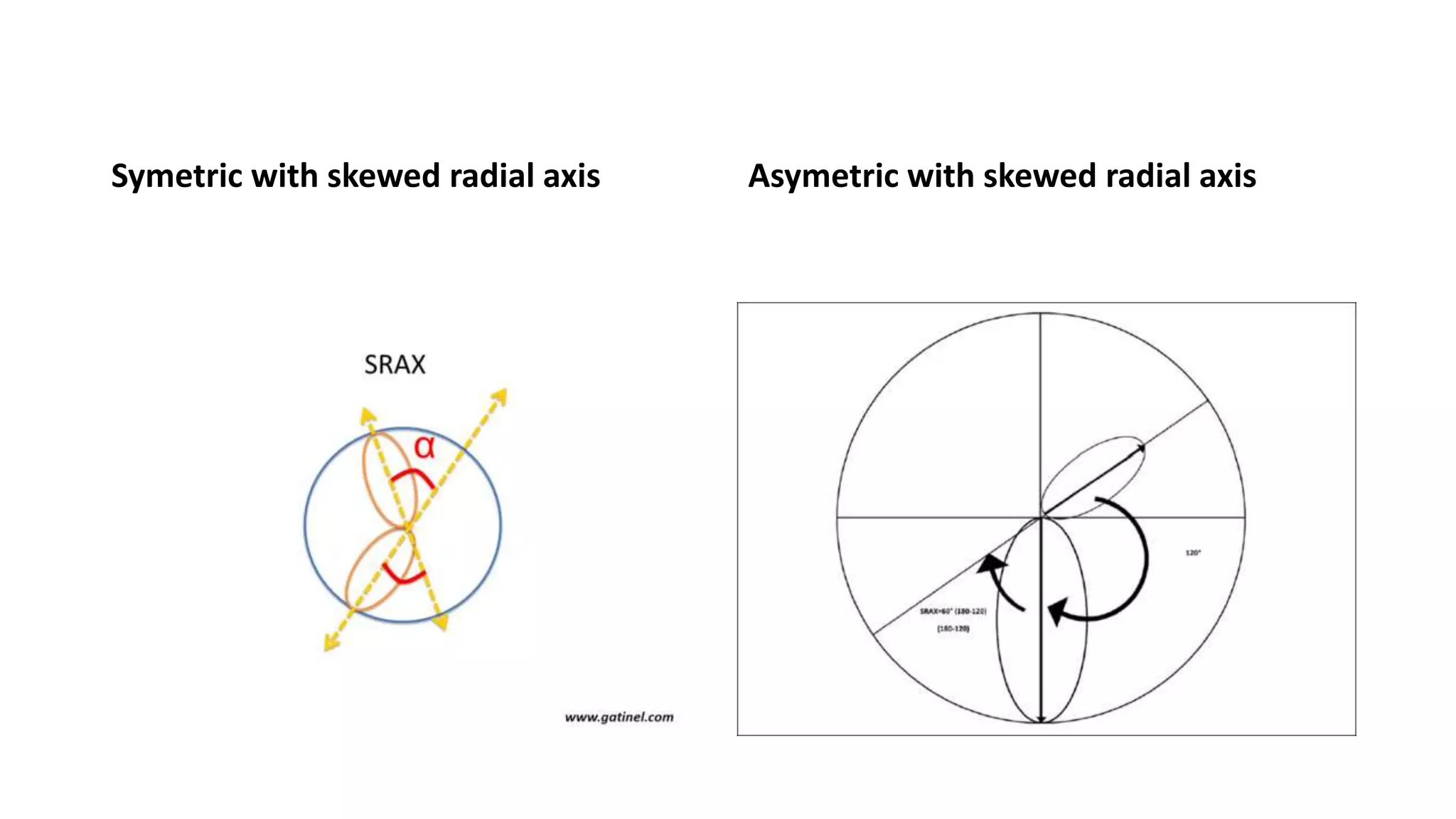 Corneal topographic patterns.pptx