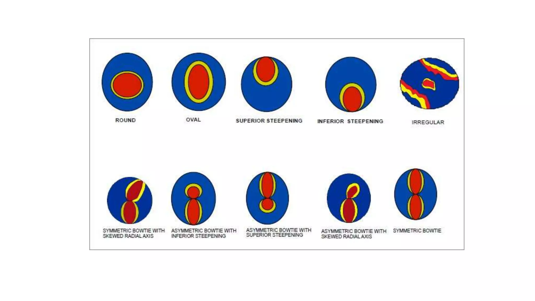 Corneal topographic patterns.pptx