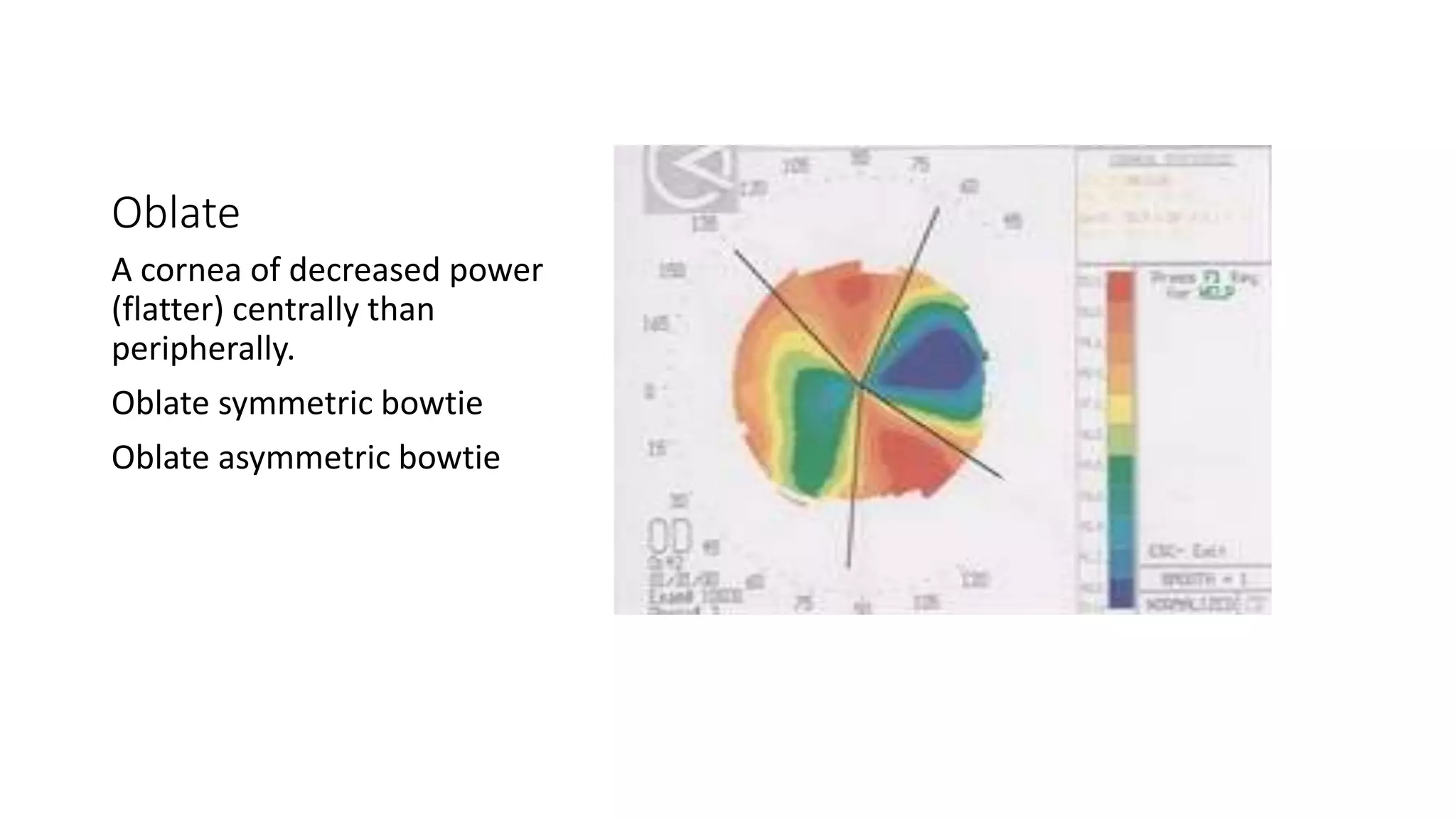 Corneal topographic patterns.pptx