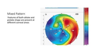 Corneal topographic patterns.pptx