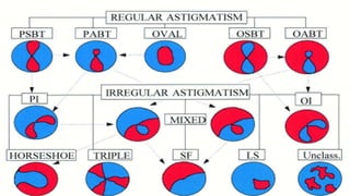 Corneal topographic patterns.pptx