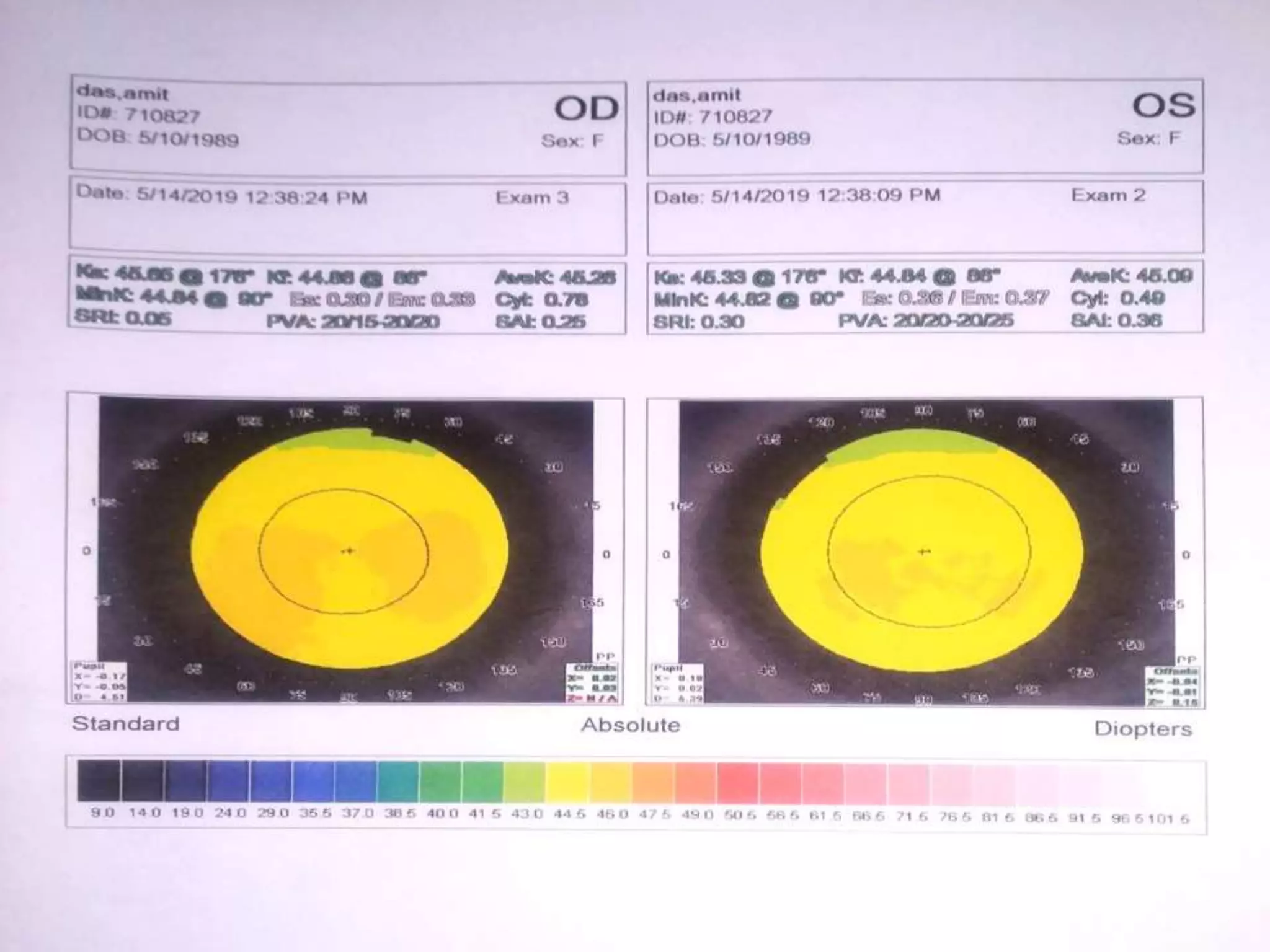 Corneal topographic reports | PPT