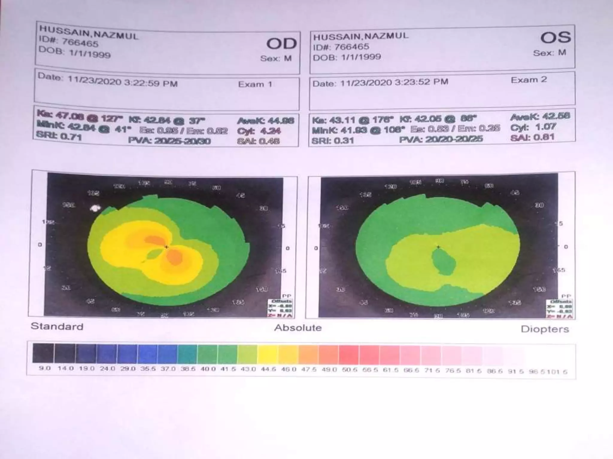 Corneal topographic reports | PPT