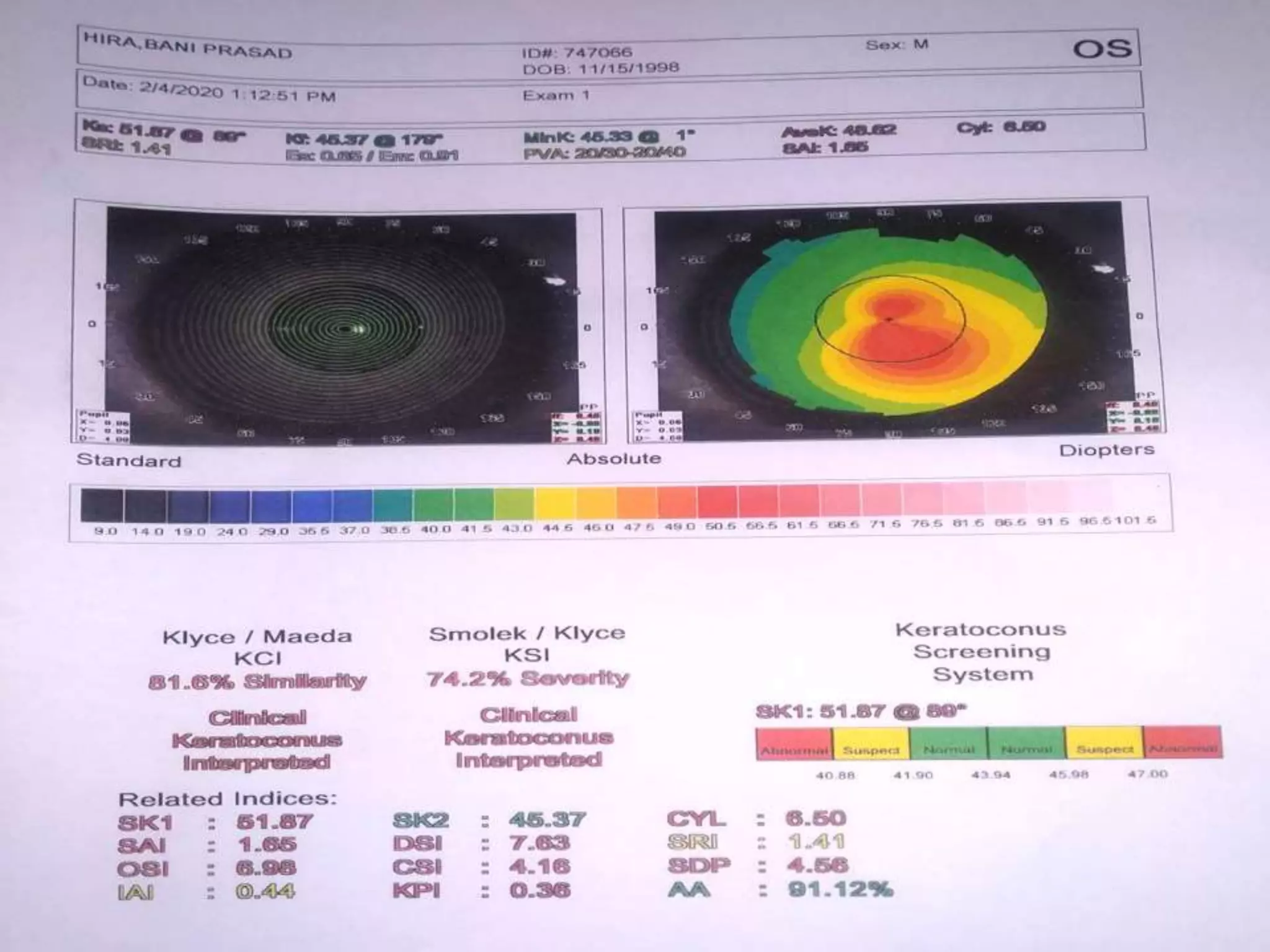 Corneal topographic reports | PPT