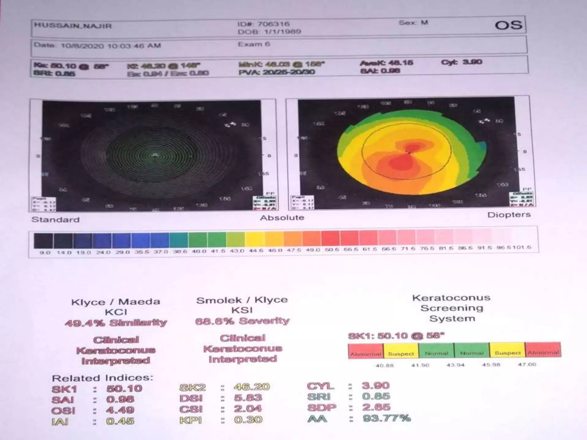 Corneal topographic reports | PPT
