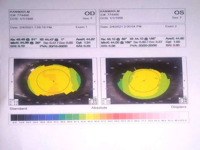 Corneal topographic reports | PPT | Free Download