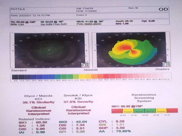 Corneal topographic reports | PPT