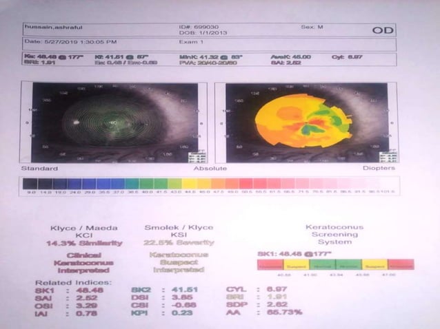 Corneal topographic reports | PPT
