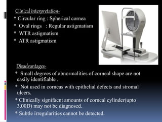 Corneal topographic reports | PPTX