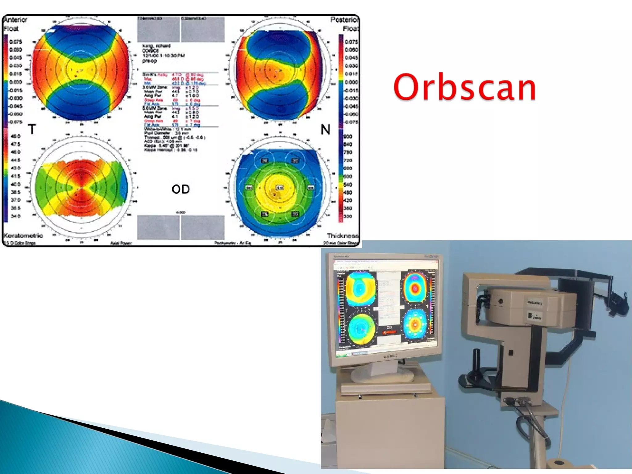 Corneal Topography | PPT