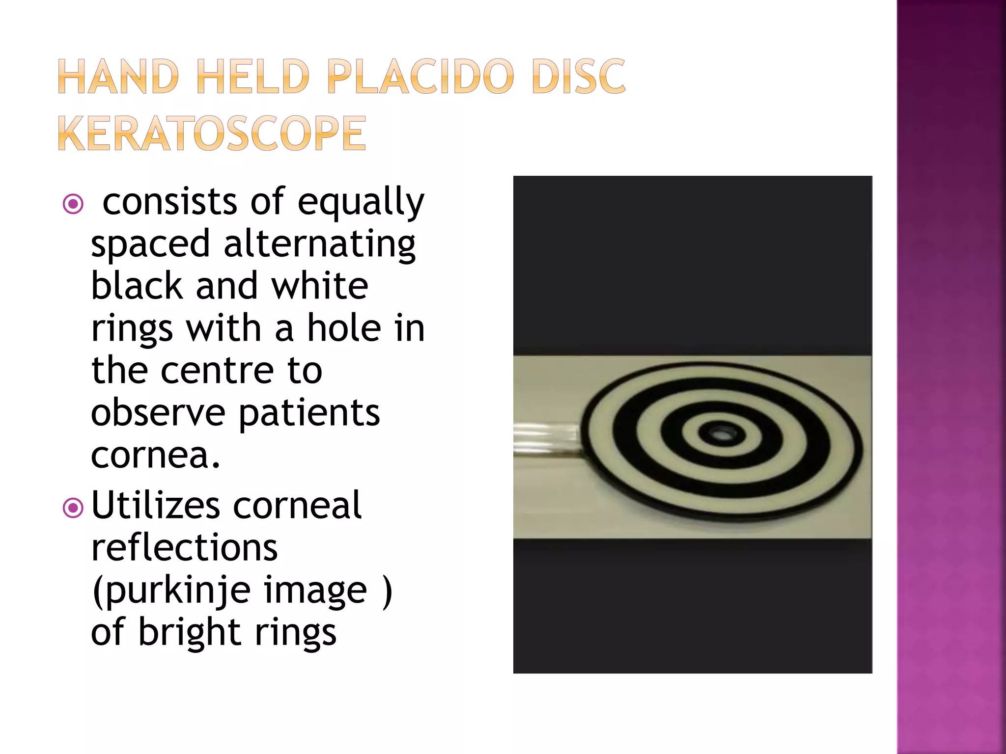 Corneal topography | PPTX