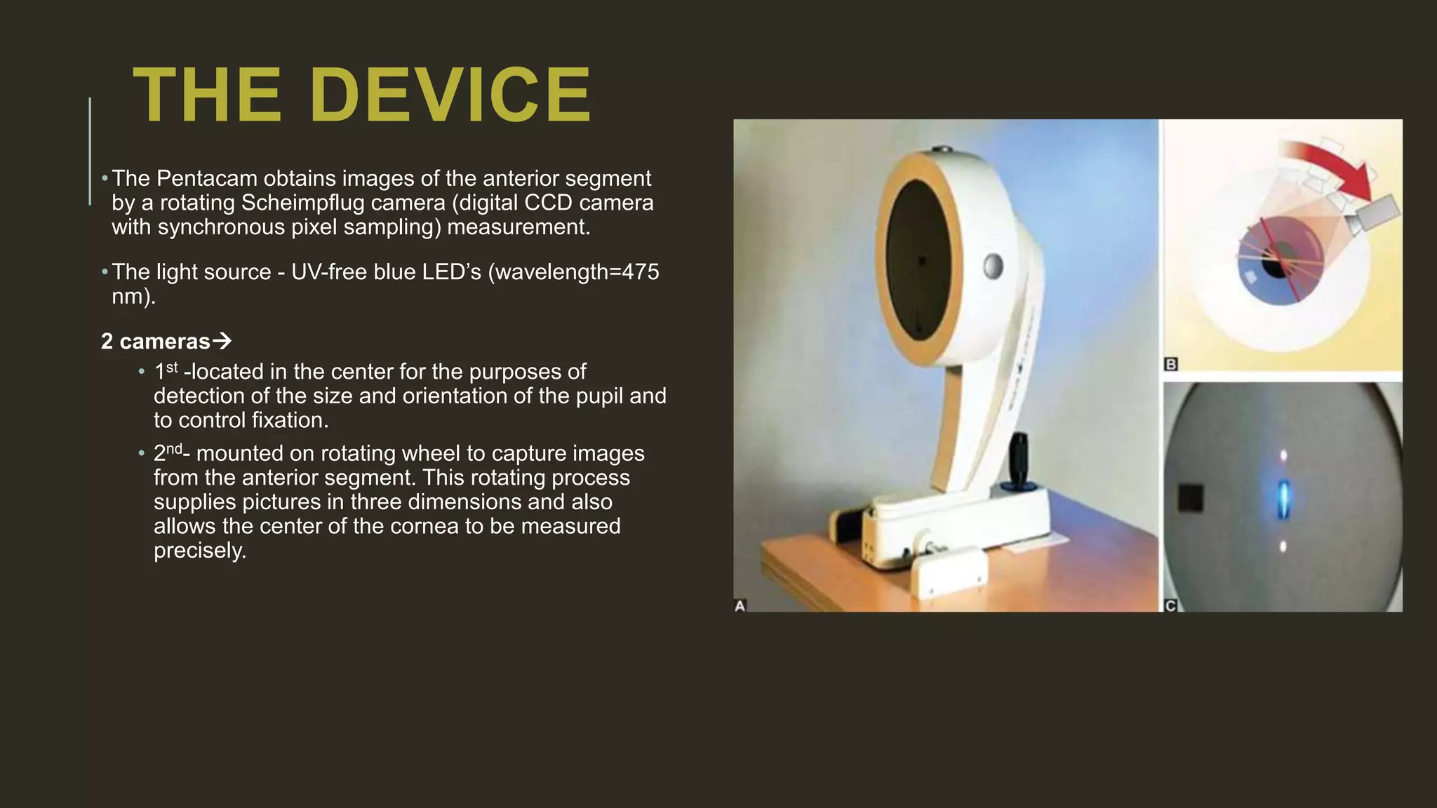 Pentacam and Corneal topography | PPTX