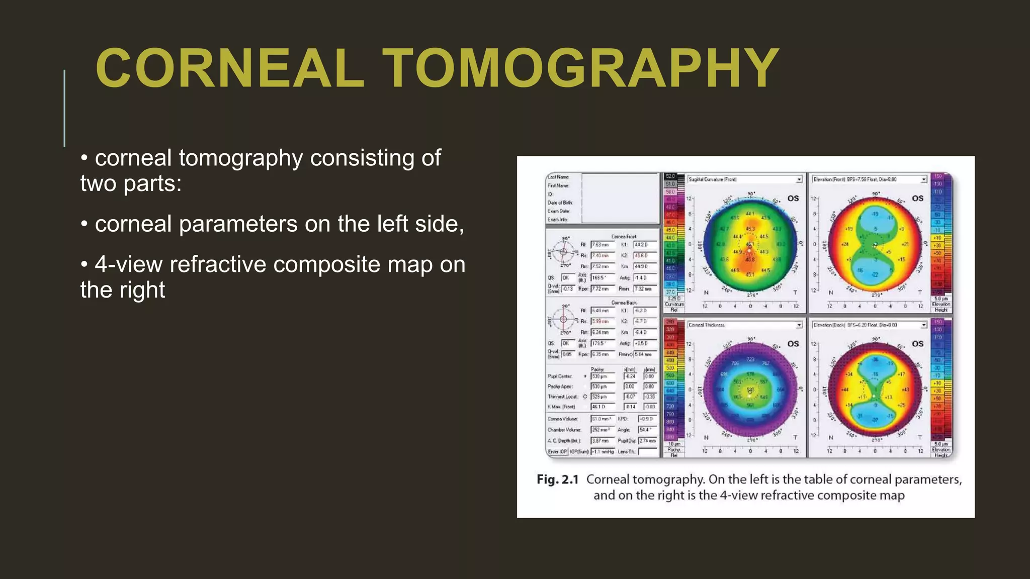 Pentacam and Corneal topography | PPTX