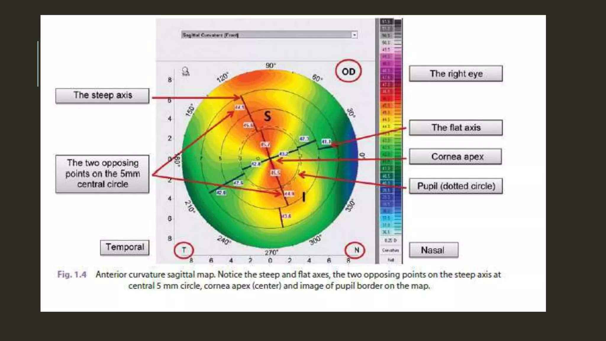 Pentacam and Corneal topography | PPTX