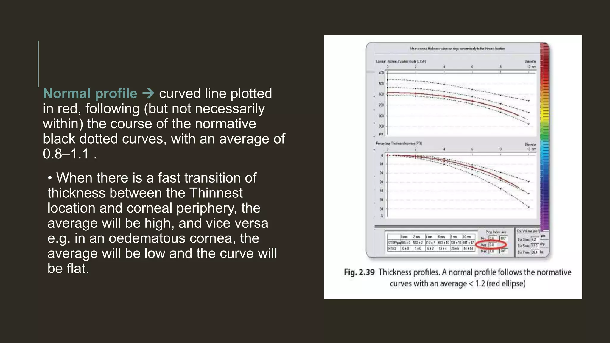 Pentacam and Corneal topography | PPTX