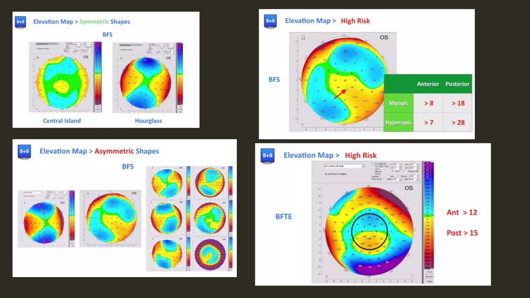 Pentacam and Corneal topography | PPTX