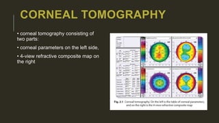 Pentacam and Corneal topography | PPTX
