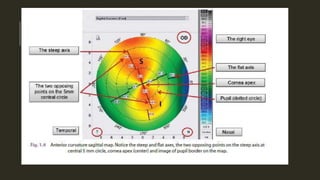 Pentacam and Corneal topography | PPTX