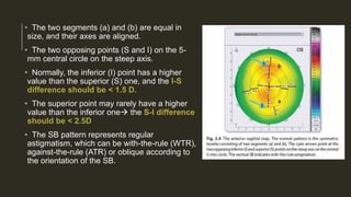 Pentacam and Corneal topography | PPTX
