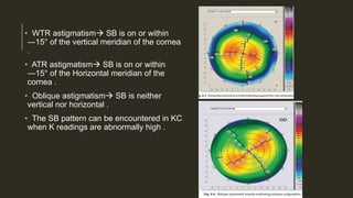 Pentacam and Corneal topography | PPTX