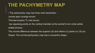 Pentacam and Corneal topography | PPTX
