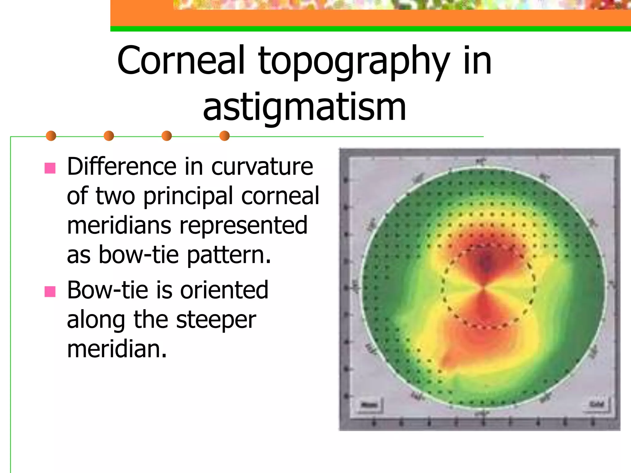 Corneal topography...ppt