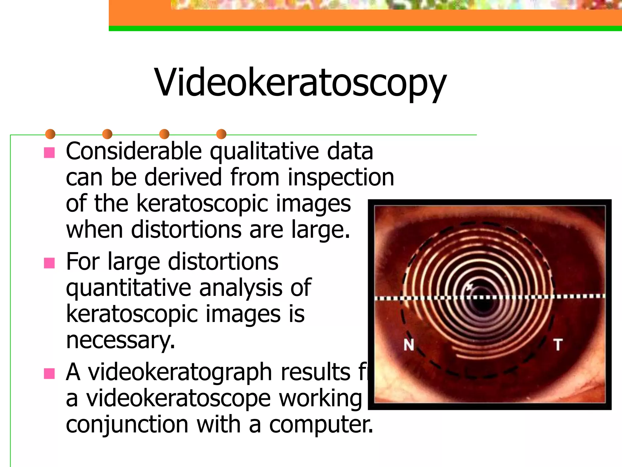 Corneal topography...ppt