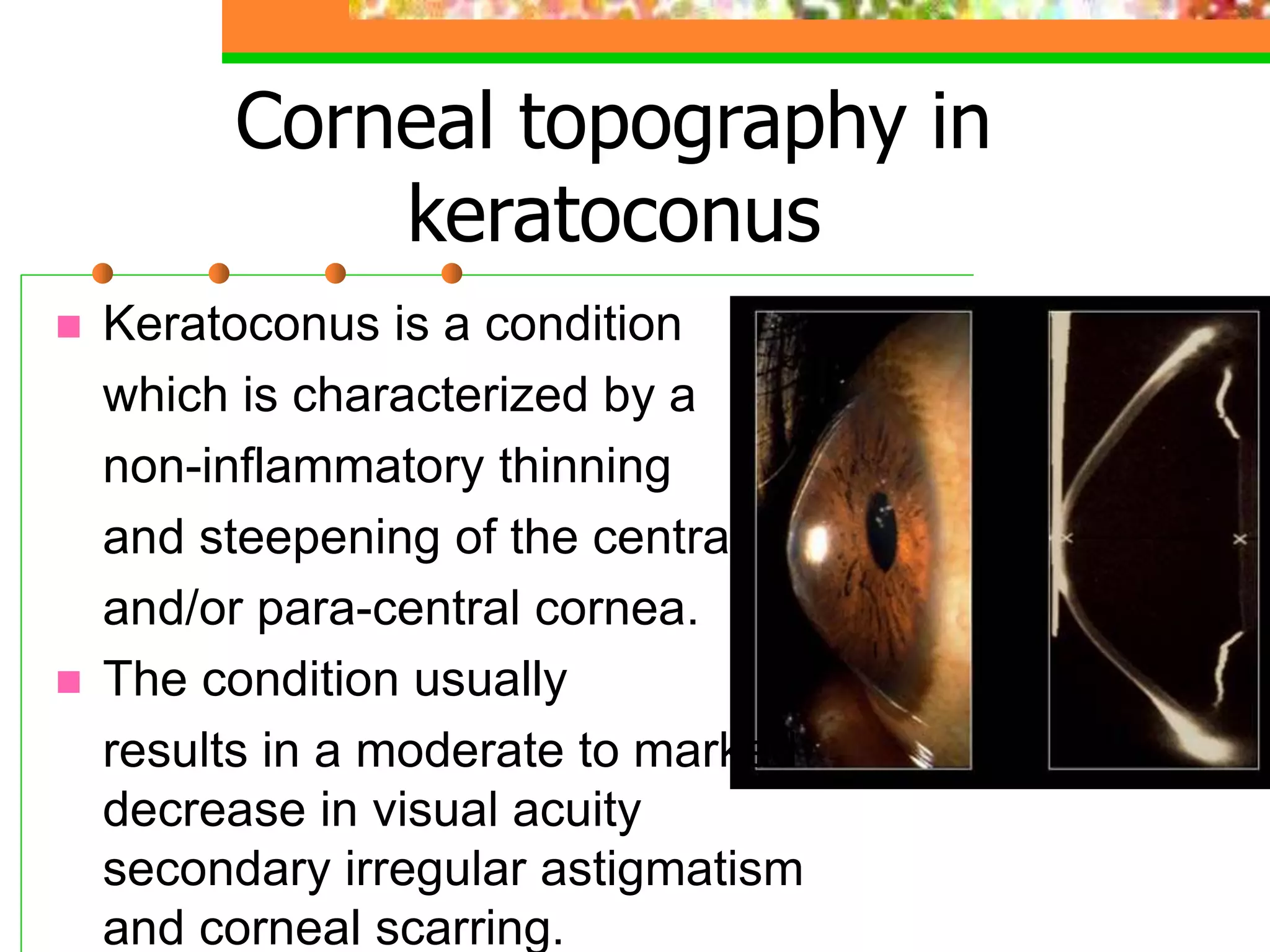Corneal topography...ppt