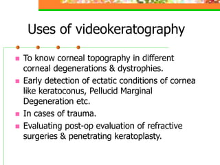 Corneal topography...ppt