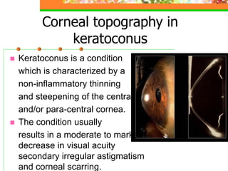 Corneal topography...ppt