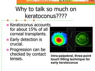 Corneal topography...ppt