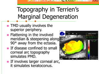 Corneal topography...ppt