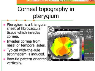 Corneal topography...ppt